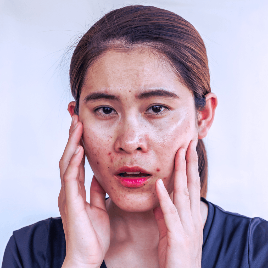 What are the skin damages caused by sunlight? - Beautaza